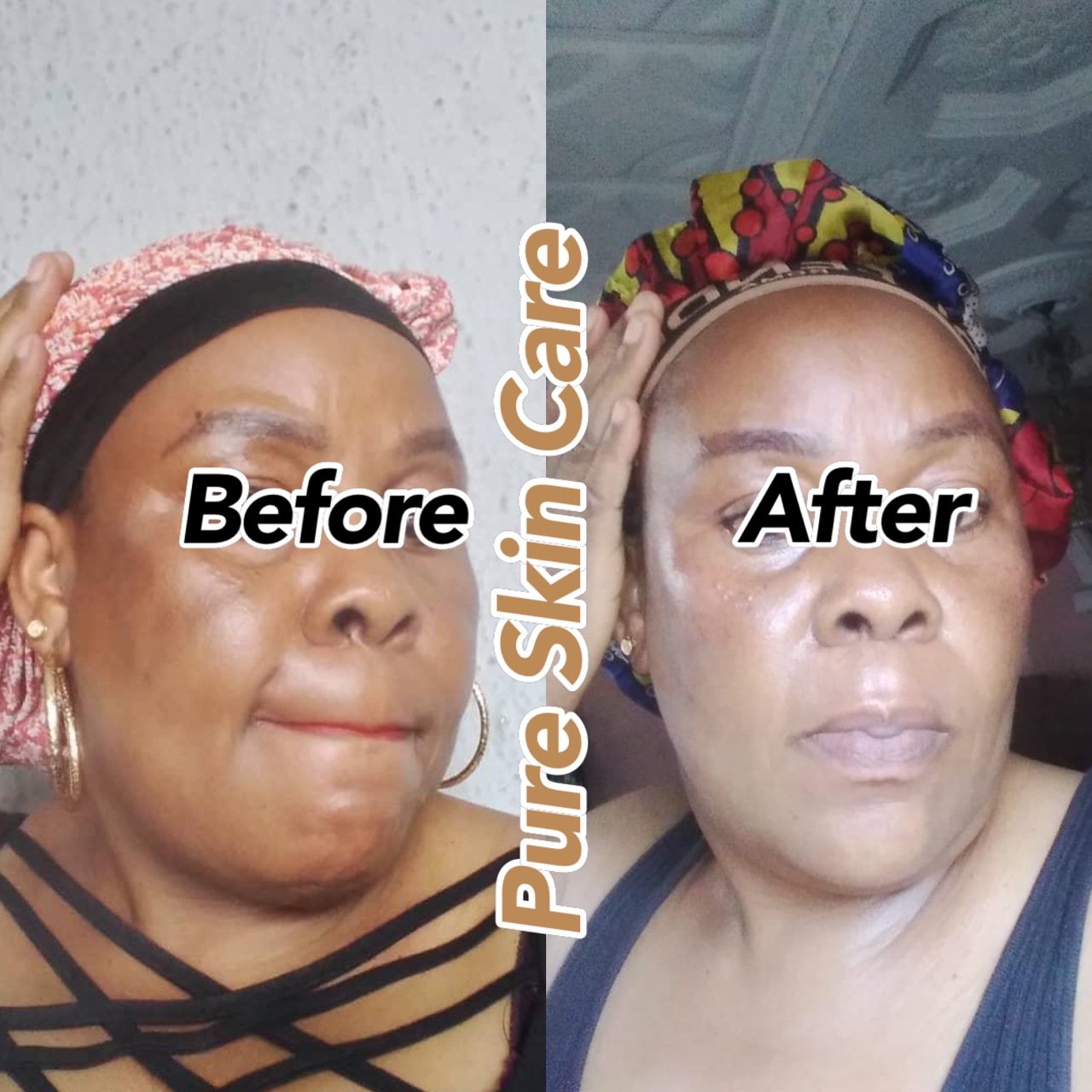 Pure Skin Skincare – A perfect solution for all your skin problems